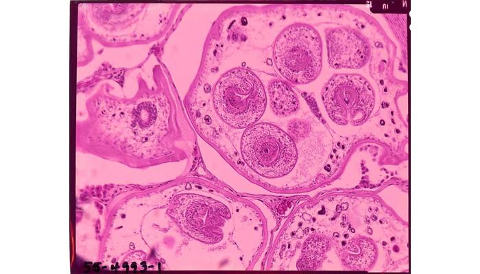 National Museum of Health and Medicine: The Micrograph - A Closer Look ...